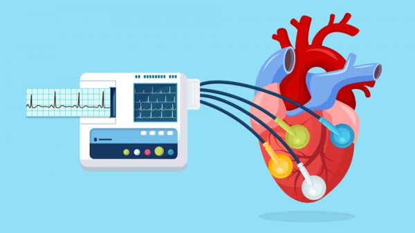 ECG Test Services At Home in Delhi NCR | Holter Monitoring Test Near Me